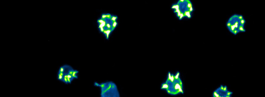 Jeff Rasmussen Q&A with the Merkel Cell Carcinoma Collaborative (MC3 ...